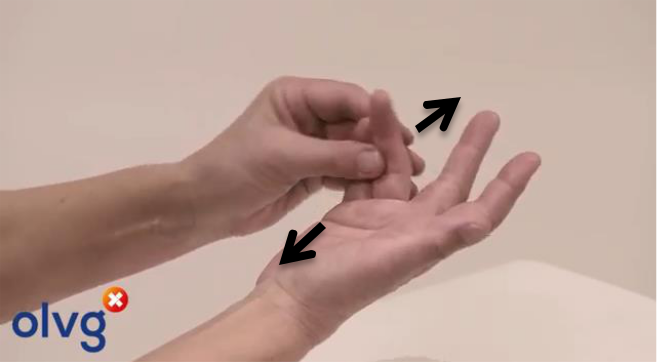 Fifth metacarpal fracture (Folder) - Catharina Ziekenhuis