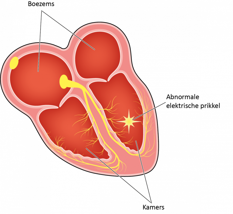 ICD (Folder) - Catharina Ziekenhuis