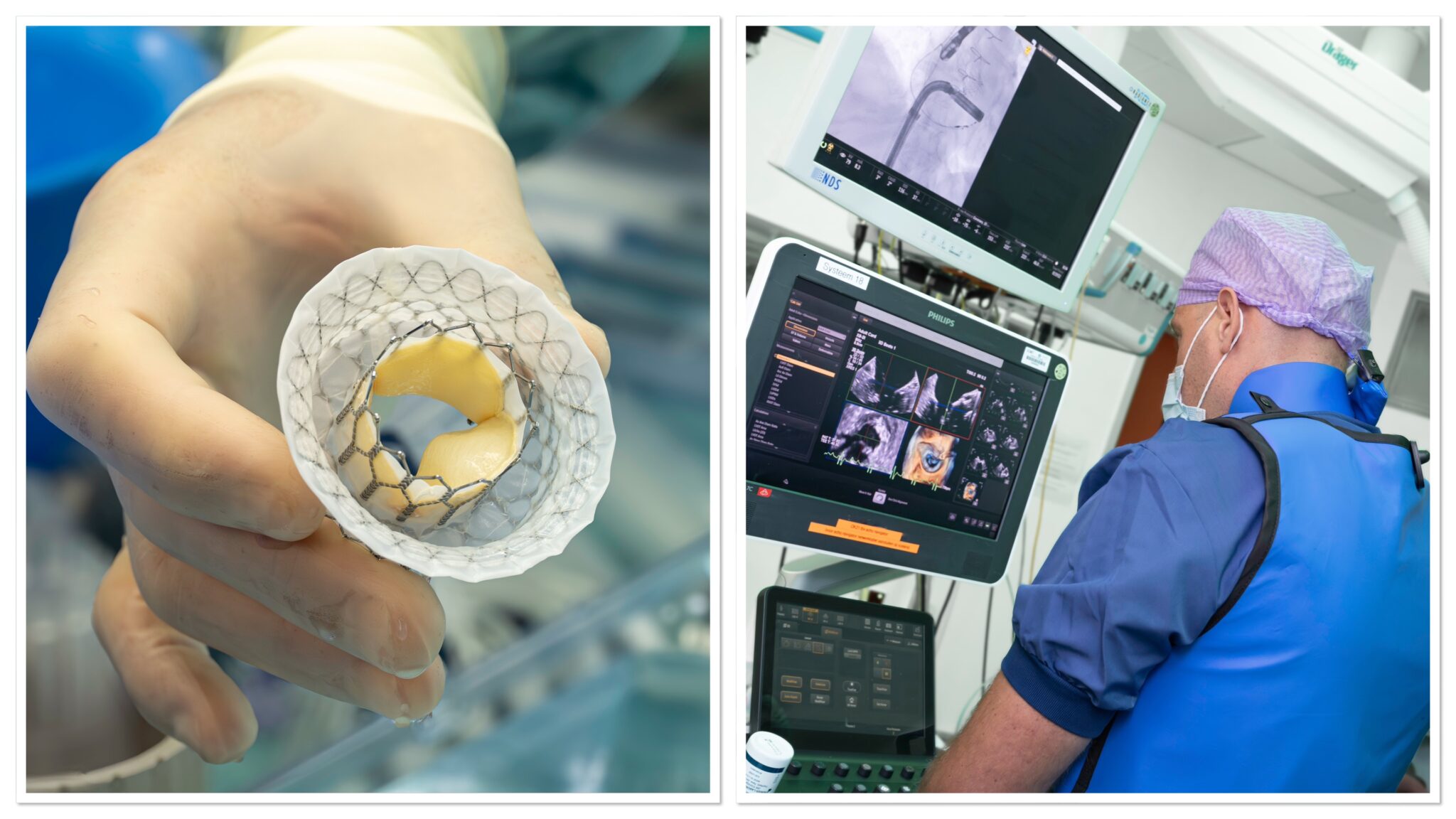 Als eerste in Europa: nieuwe hartklep via lies biedt hoop voor ...