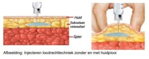 Subcutaan injecteren (Folder) - Catharina Ziekenhuis